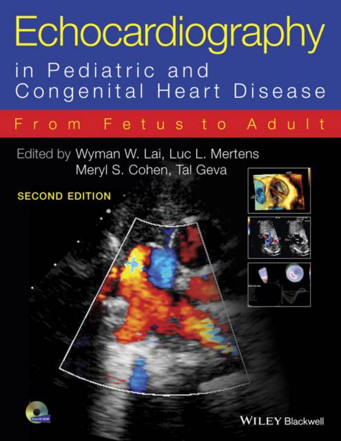 Echocardiography in Pediatric and Congenital Heart Disease | Wyman W ...