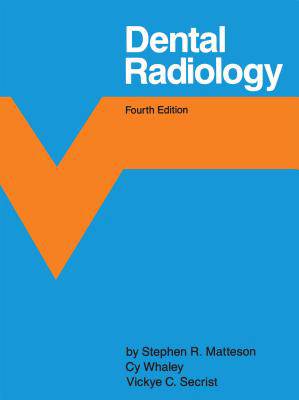 Dental Radiology | Stephen R Matteson, Cy Whaley, Vickye C Secrist ...