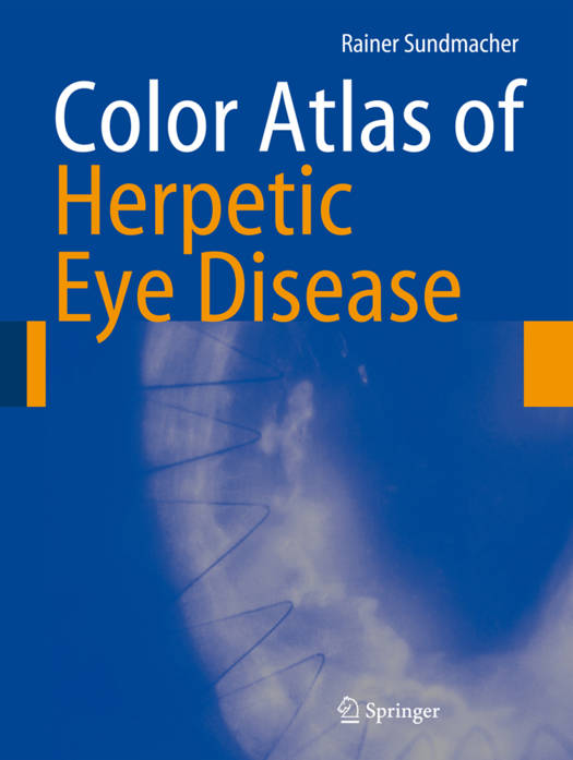 Color Atlas of Herpetic Eye Disease | Rainer Sundmacher | Interne ...